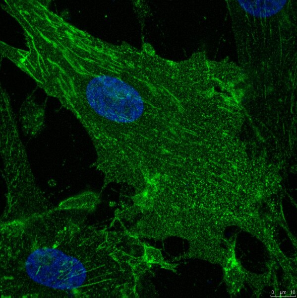Anti-Integrin alpha 5 (CD49e) Antibody, clone mAb11 | MABT822